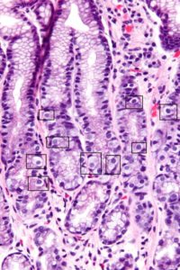 GI Hormones of Digestion & Fast | Medical Science Navigator