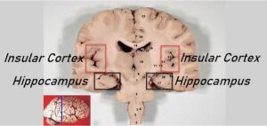Smooth Muscle A&P | Medical Science Navigator
